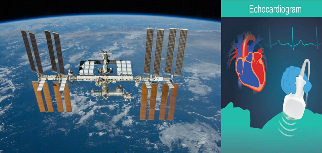 Astronauts to perform cardiac ultrasound in outer space - ECS International
